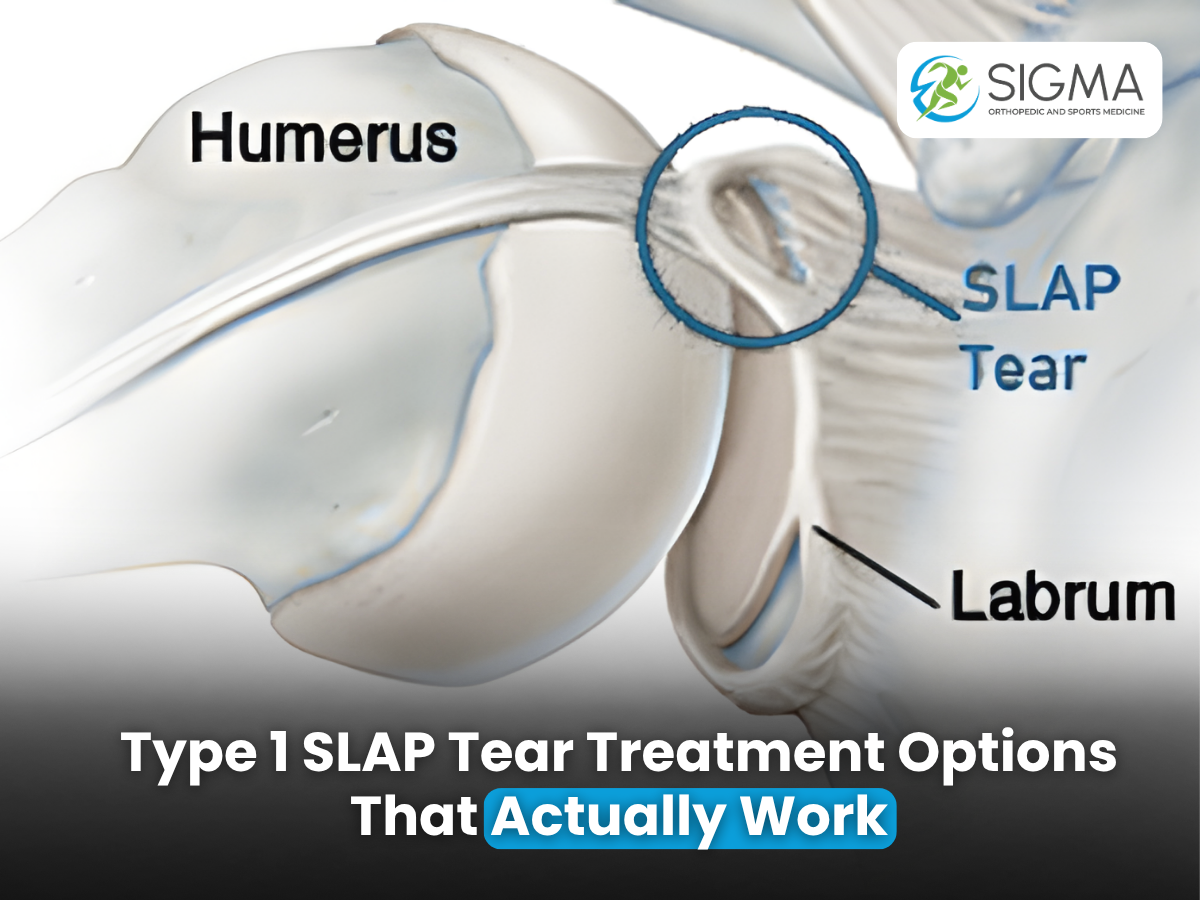Type 1 SLAP Tear Treatment Options & Recovery Guide