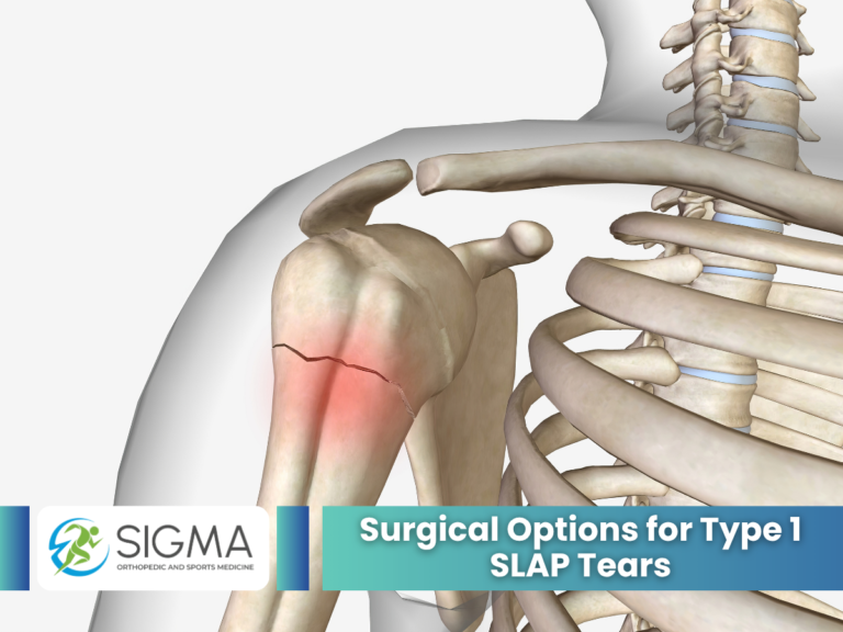 Type 1 SLAP Tear Treatment Options & Recovery Guide